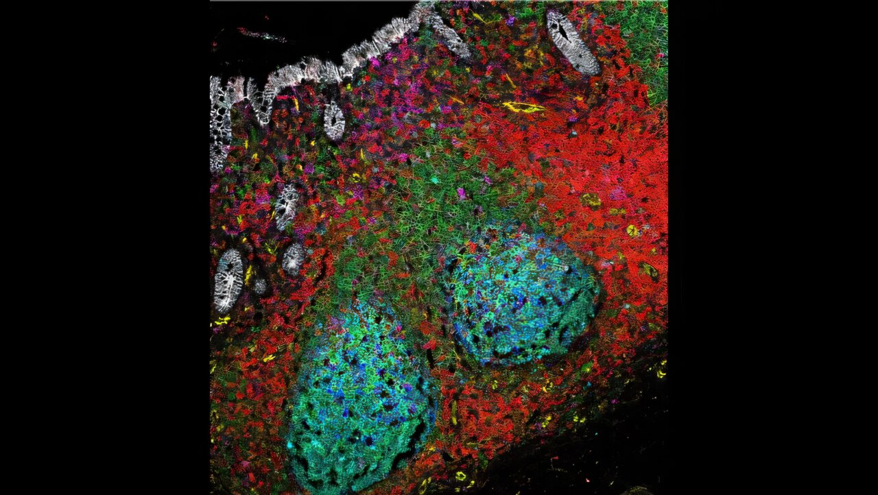 Mapping immune cell interactions in gut tissue reveals changes in ...