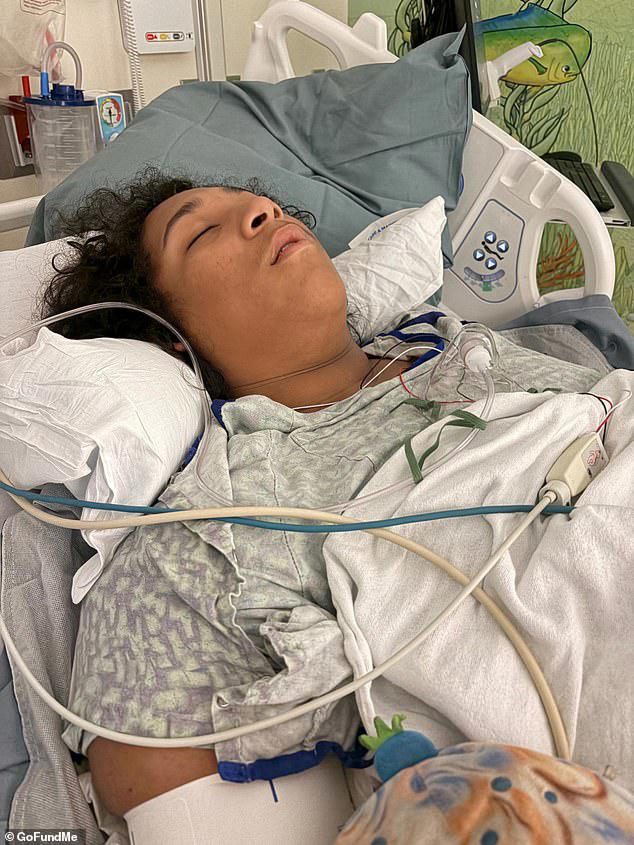 Boy, 17, contracts deadly flesh-eating bacteria after swimming at park ...
