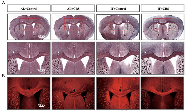 How intermittent fasting may shield the brain from chronic stress