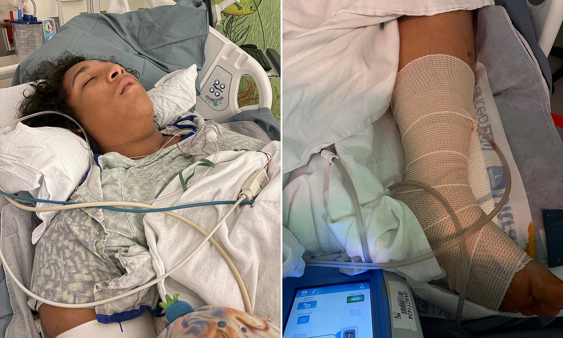 Boy, 17, contracts deadly flesh-eating bacteria after swimming at park ...