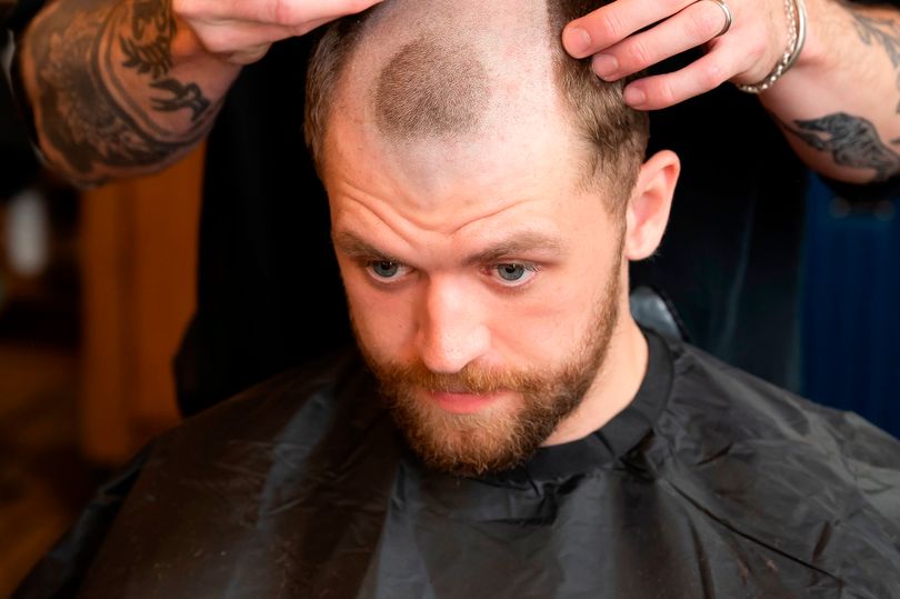 England superfan gives himself Thomas Tuchel's bald island haircut for ...