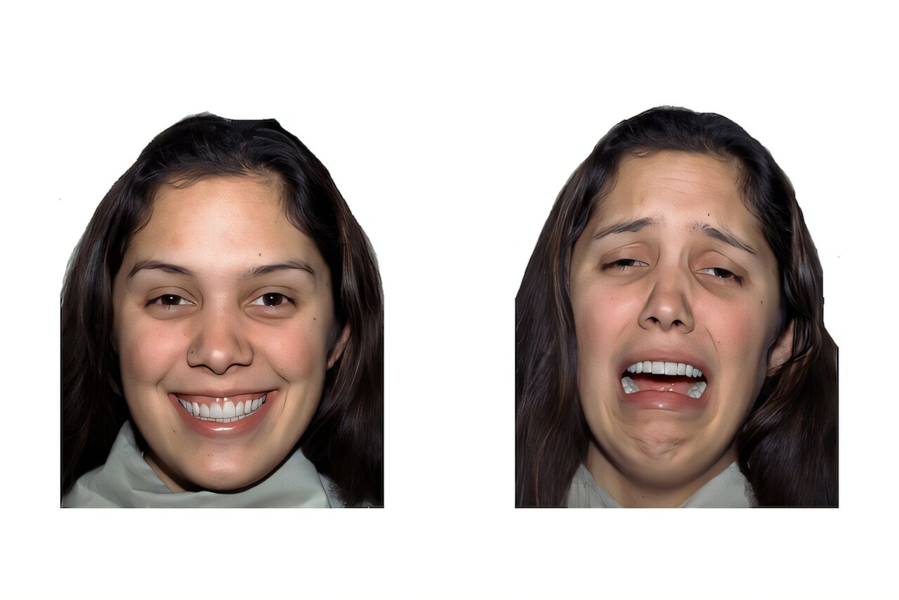 Depression may rewire how kids pay attention to emotional faces