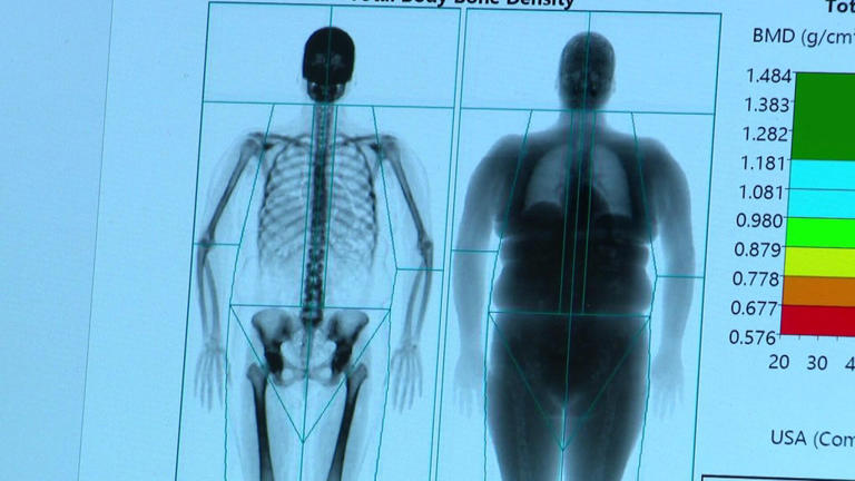 Losing weight with a GLP-1? Here's how to preserve your muscle mass.