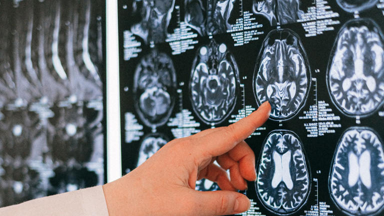 Researchers tied a healthy heart to a healthier brain in a large long ...