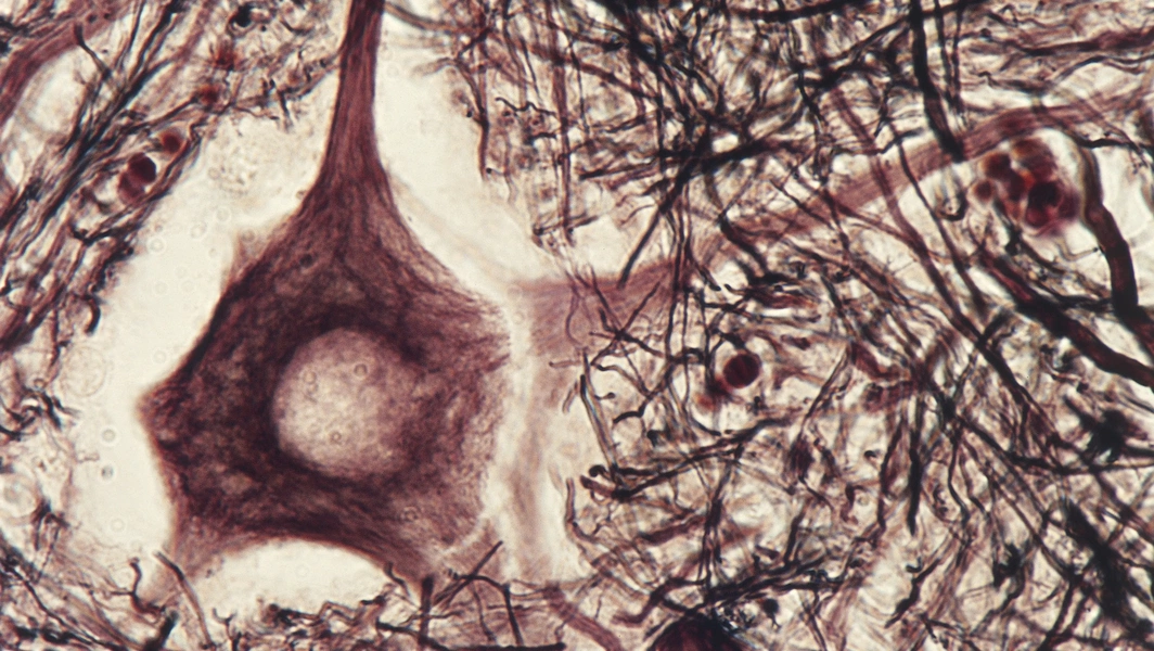 Gene activity patterns map brain’s wiring across regions