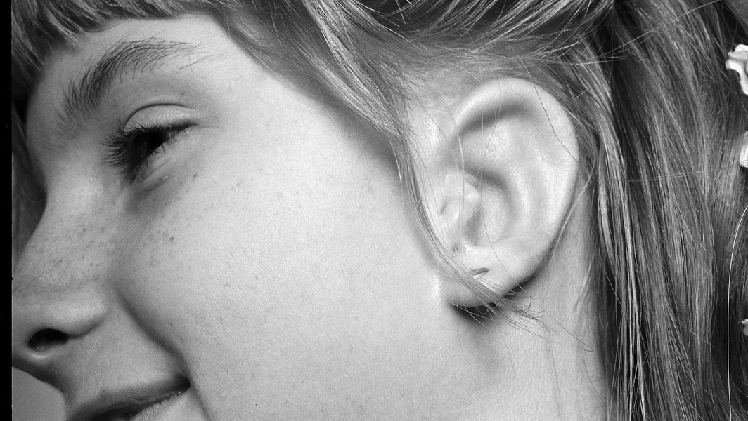12 rare genetic traits and their unique effects