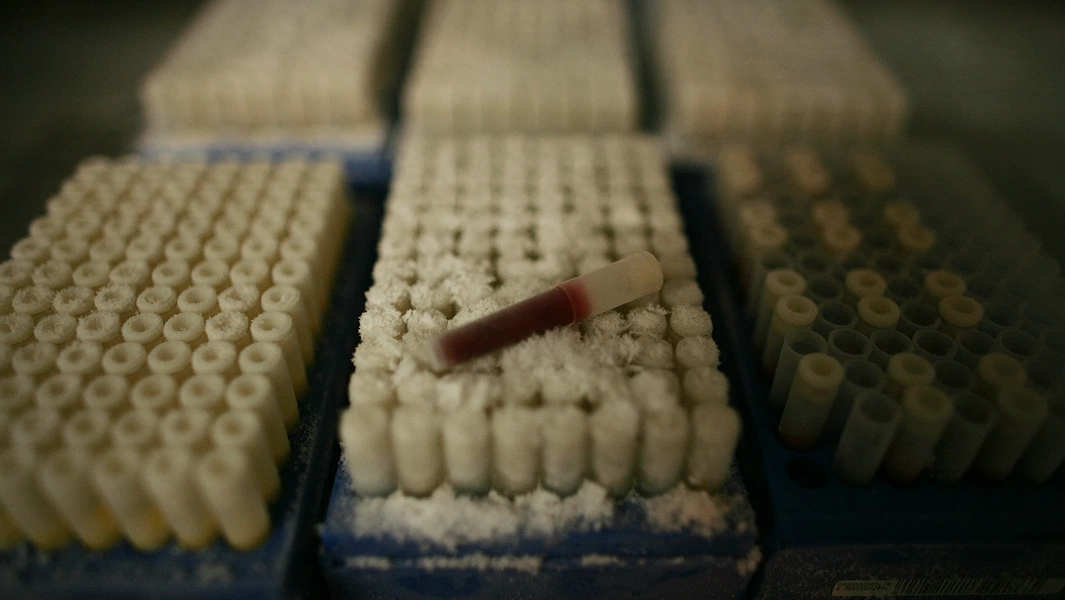 Study links higher tyrosine levels in men to shorter lifespan