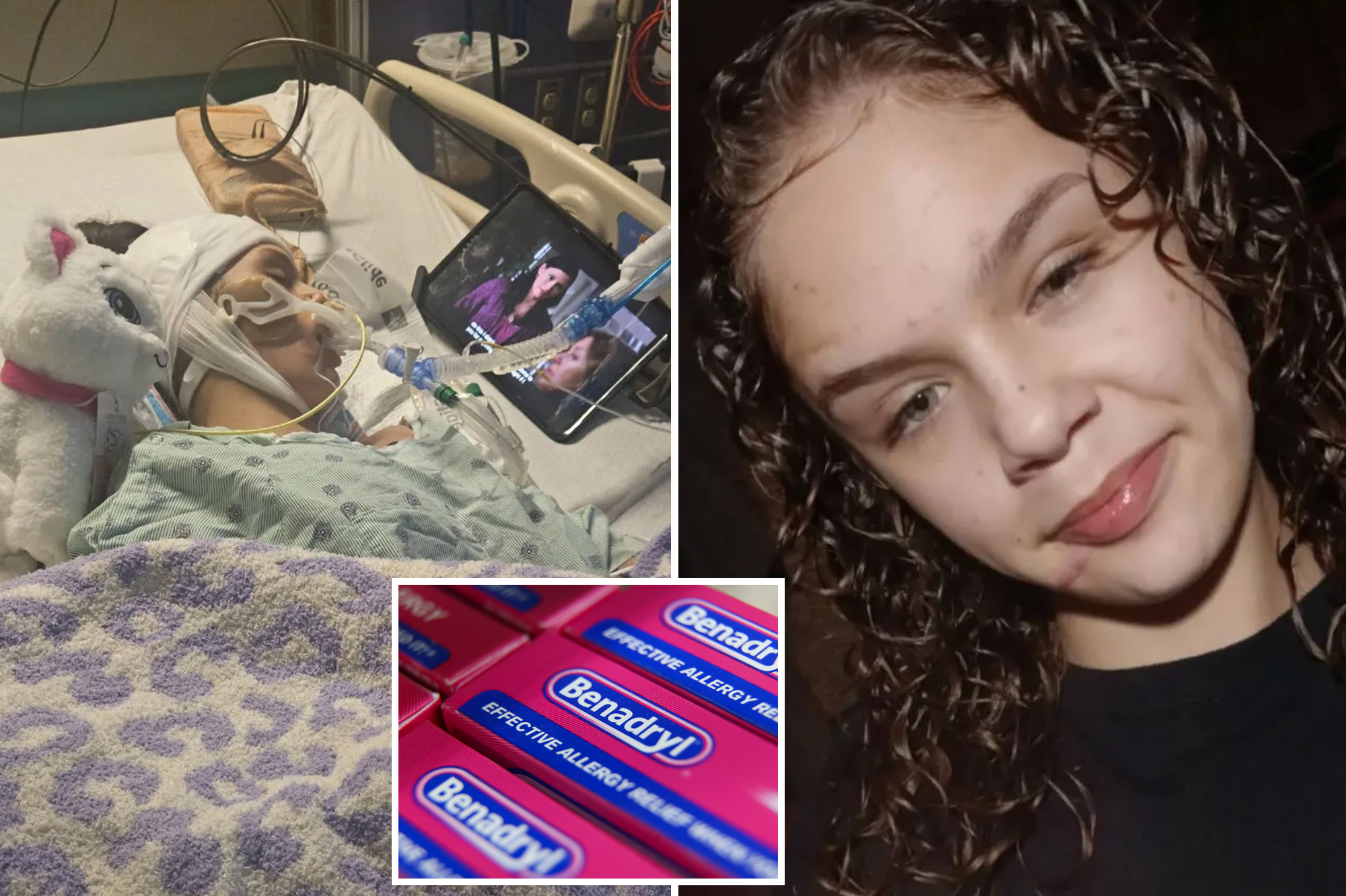 Oklahoma girl, 15, brain dead after dangerous 'Benadryl challenge': family