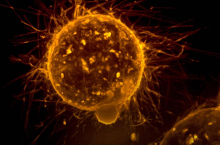 Many cancers originate from a single cancer cell and evolve through ...