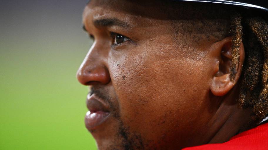 Guardians' Jose Ramirez undergoes successful surgery on hand injury