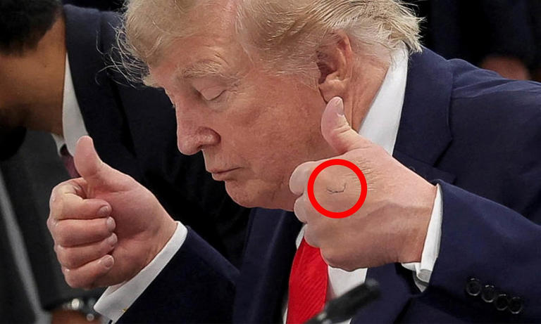 Trump spotted with unusual new mark on hand