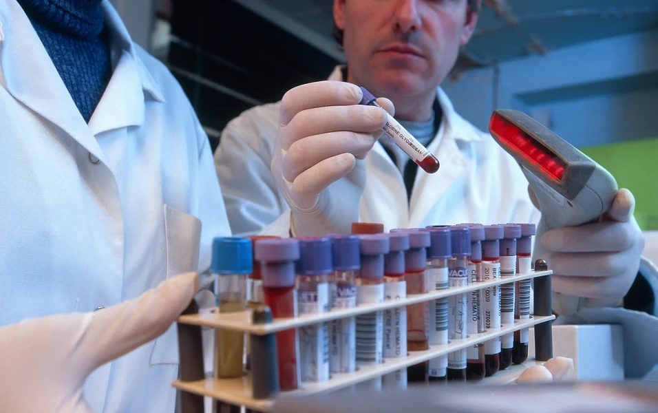 Study links higher tyrosine levels in men to shorter lifespan