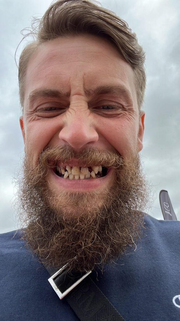Dad quit £1.5k cocaine binges after starting daily ice baths