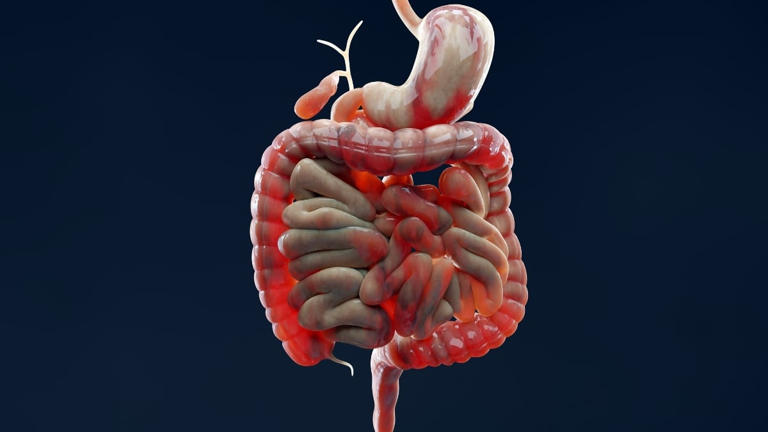 Scientists solve a 30-year mystery behind inflammatory bowel disease