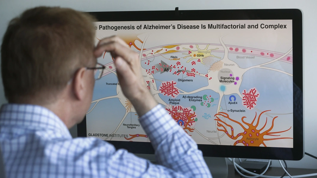 Biological and lifestyle factors that protect the aging brain