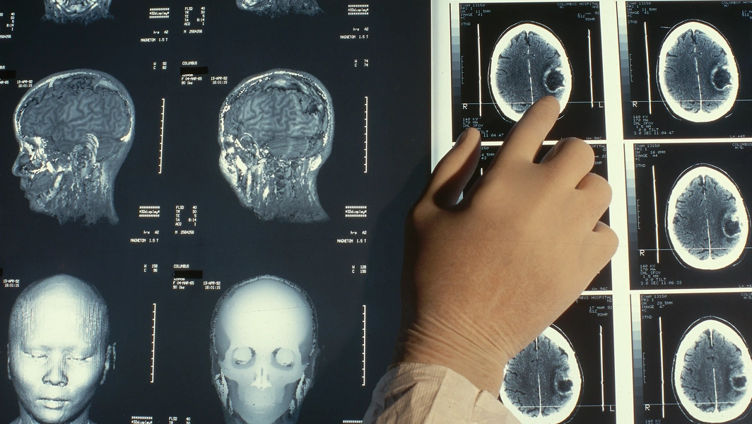 Daily brain training linked to cognitive gains at any age