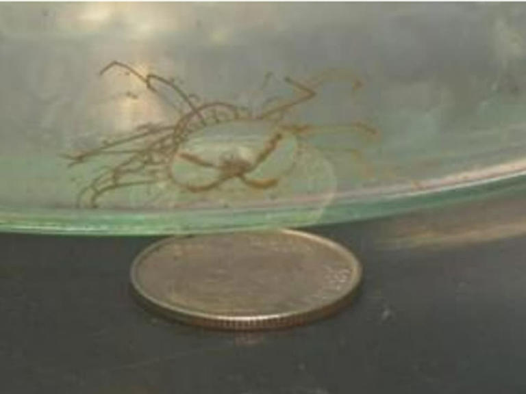 Child hospitalized from painful jellyfish sting at Jersey Shore, report ...