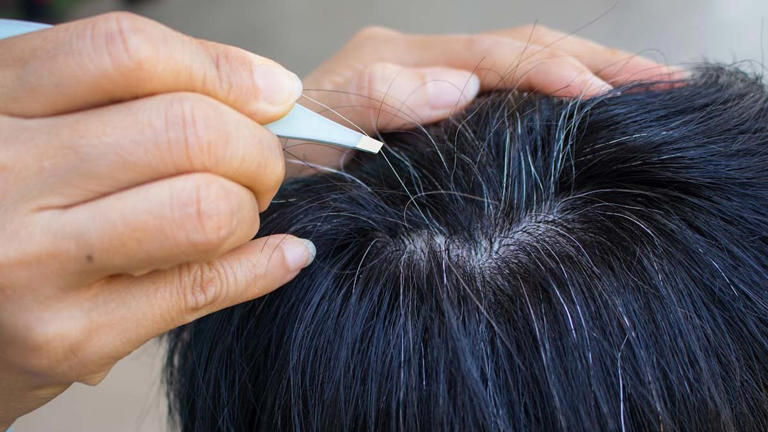 Is greying at 35 normal, and can it be reversed? A dermatologist explains