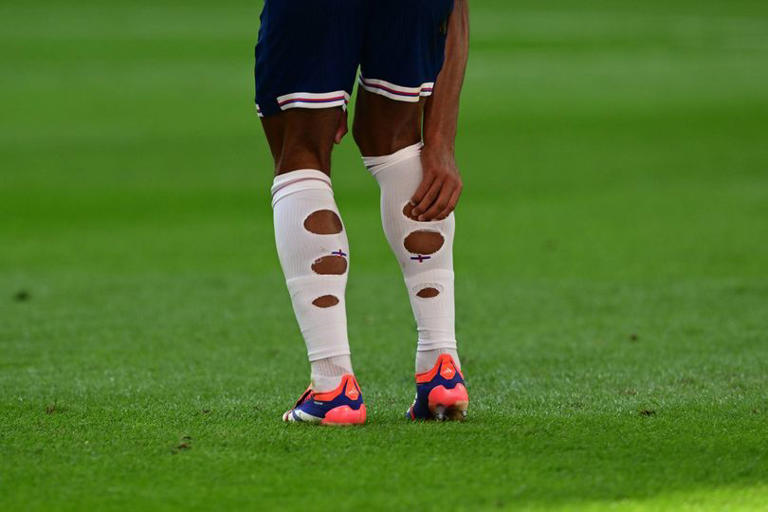 England fans baffled over holes in players' socks - but there's good reason