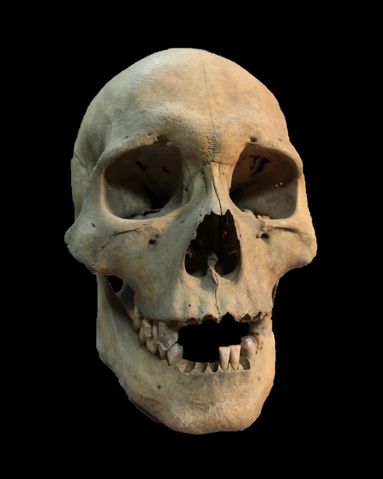 Ancient teeth rewrite what we know about plague’s timeline