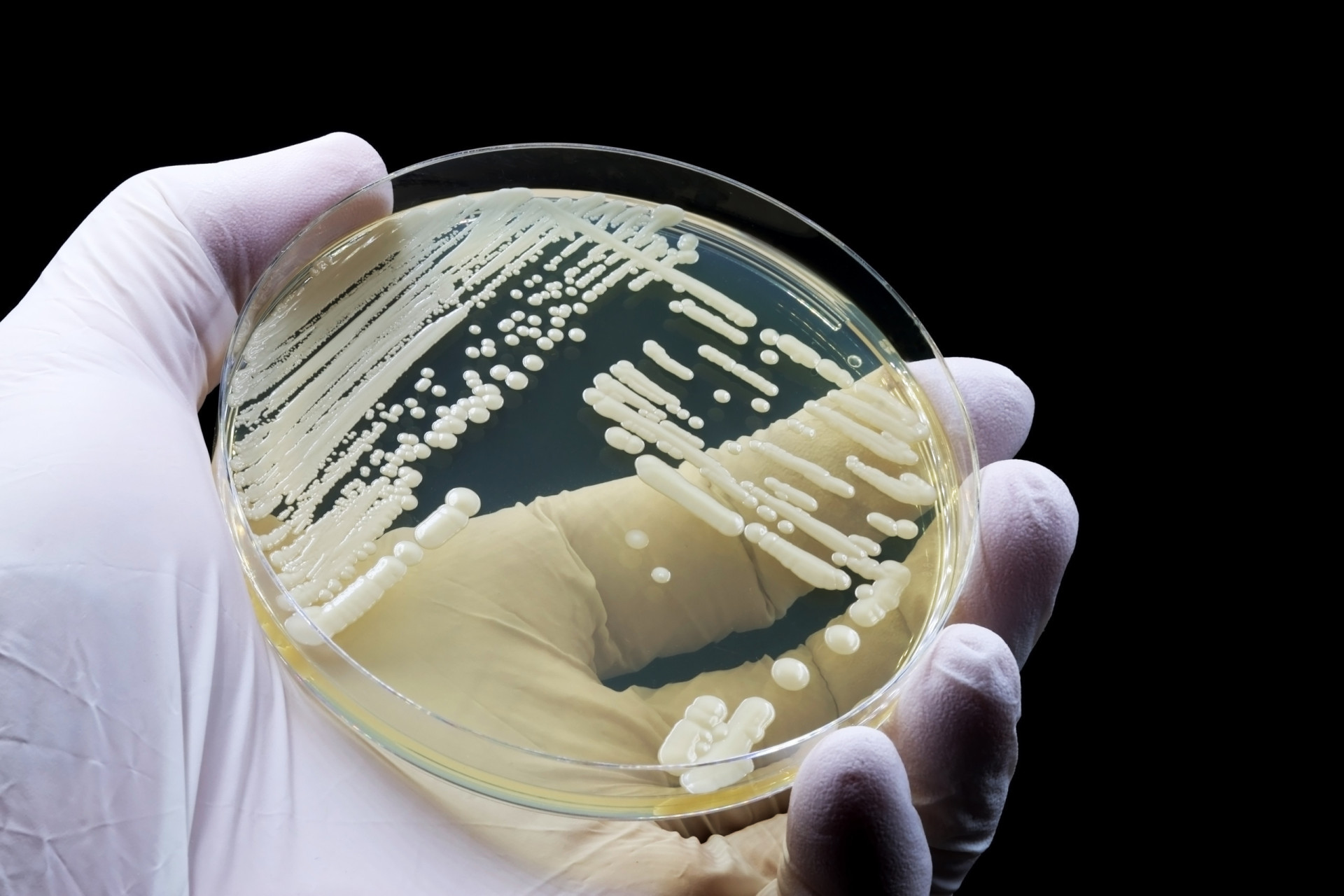 Rising concerns over brain-eating amoeba infections