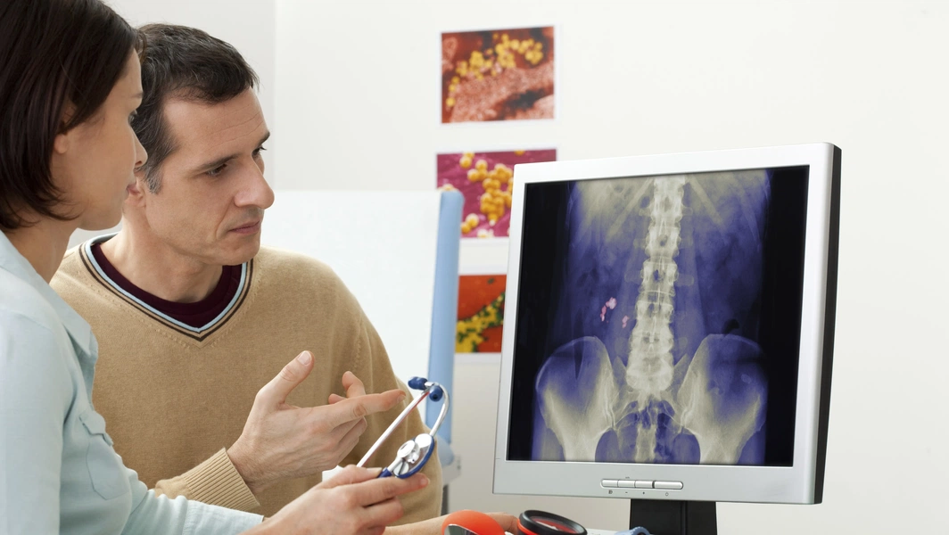 Practical habits to lower kidney stone risk
