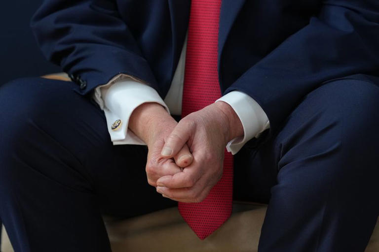 Breathless Donald Trump, 80, appears 'exceedingly unwell' as hoarse ...