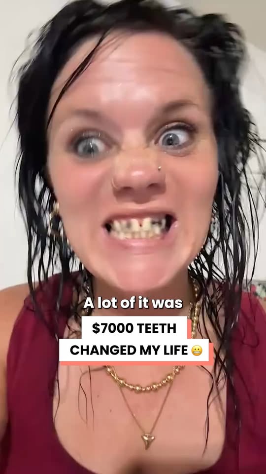 My $7,000 teeth changed my life