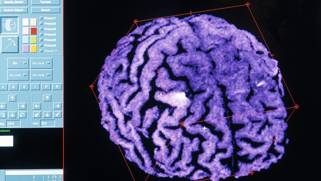 Build your brain through better writing habits