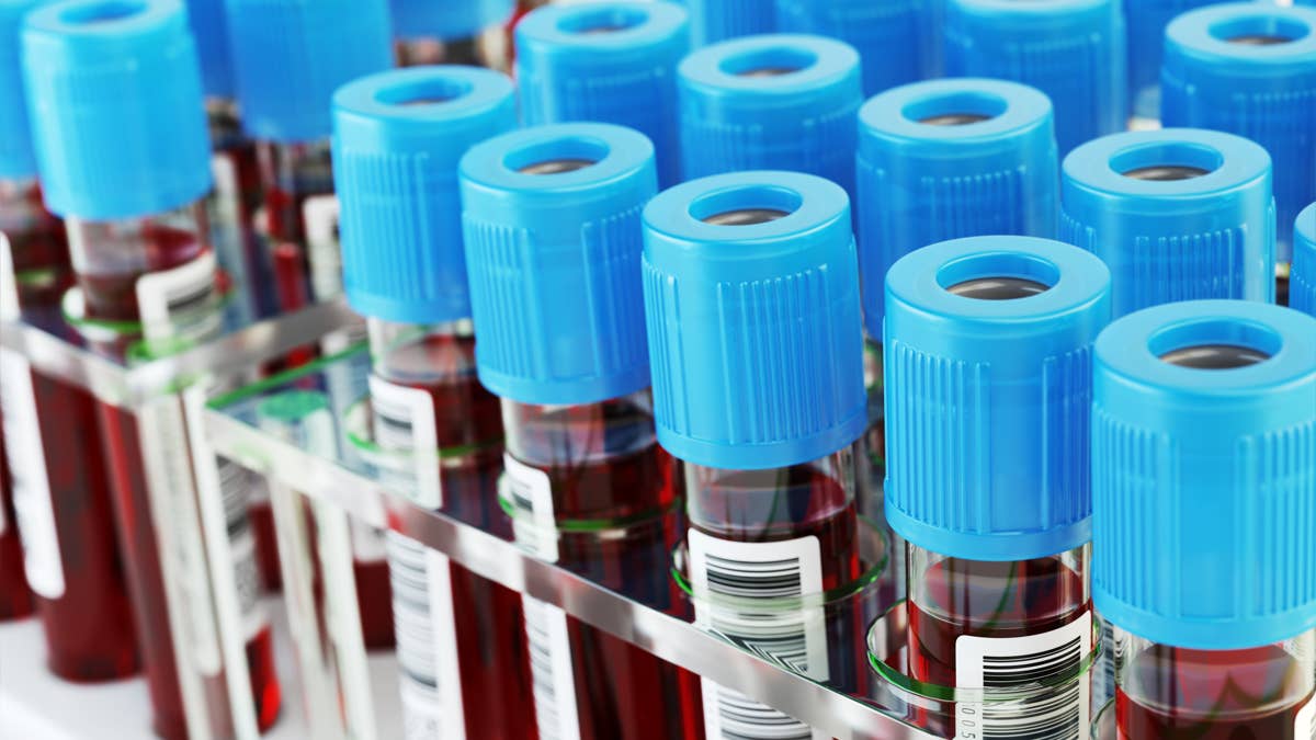 Blood tests can now detect Alzheimer's. Should healthy adults get one?