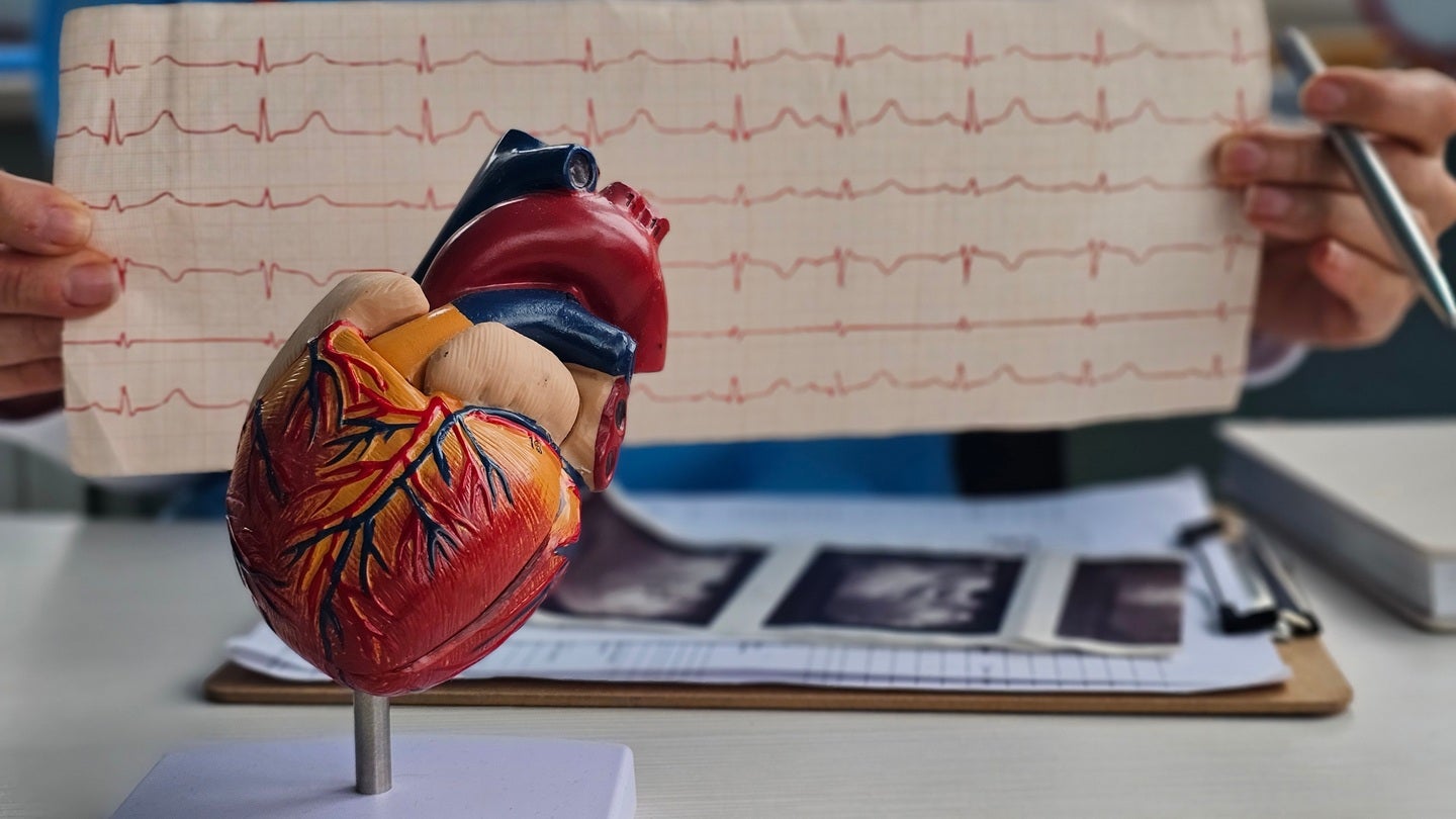 Edgewise reports positive top-line results from Phase II CIRRUS-HCM trial