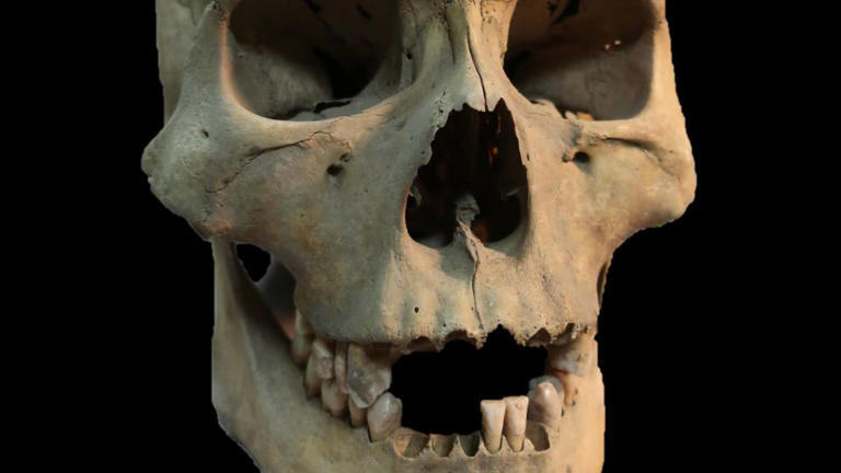 Oldest known evidence of plague reveals the disease’s deadly impact ...