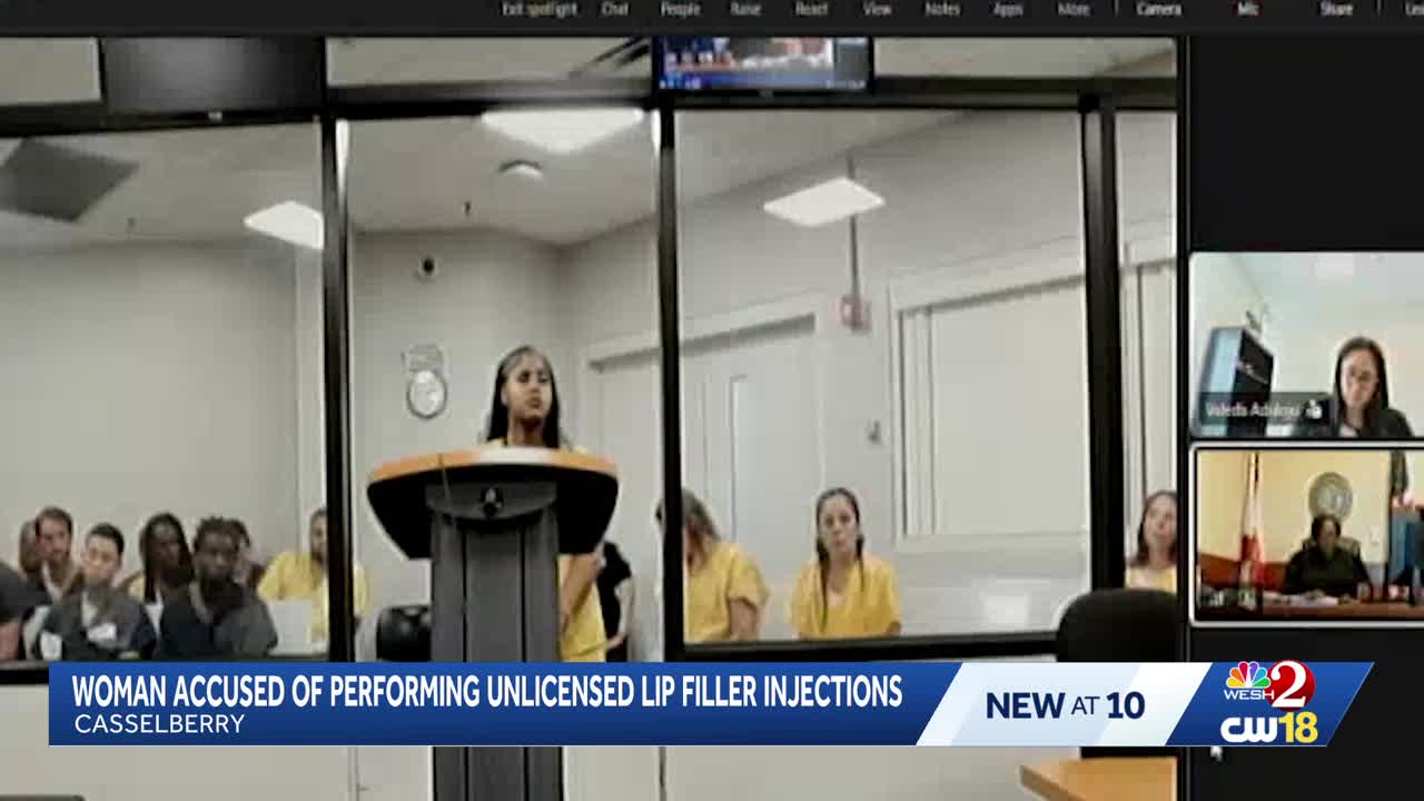Woman accused of performing unlicensed lip filler injections out of ...