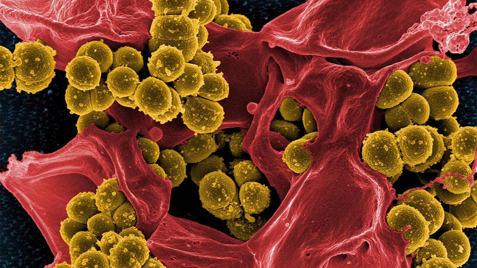 Cefazolin proves its mettle for methicillin-susceptible staph infections