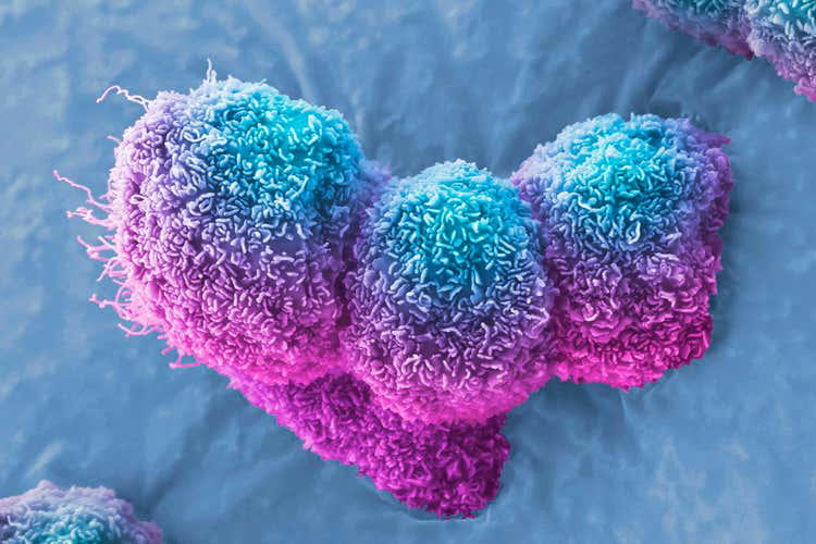 No young women have died of cervical cancer in England for years