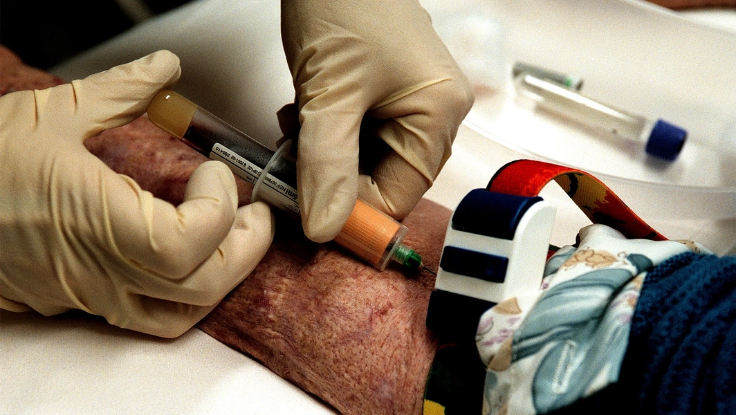 Why lupus diagnosis is often delayed