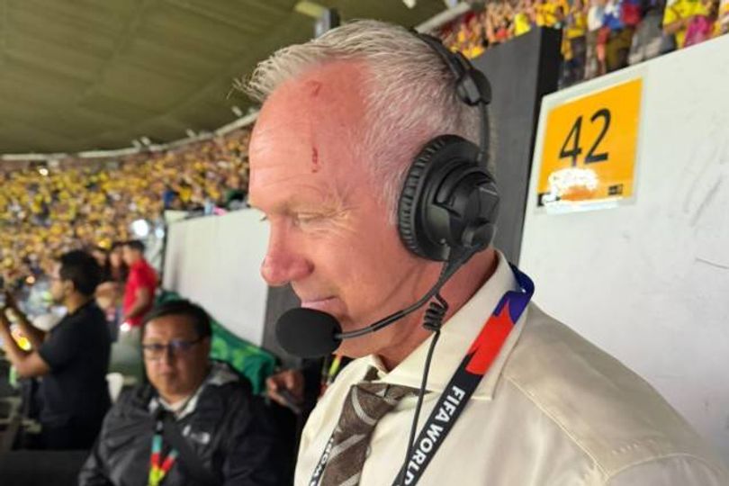 FOX analyst left bleeding at World Cup after being struck in head by ...
