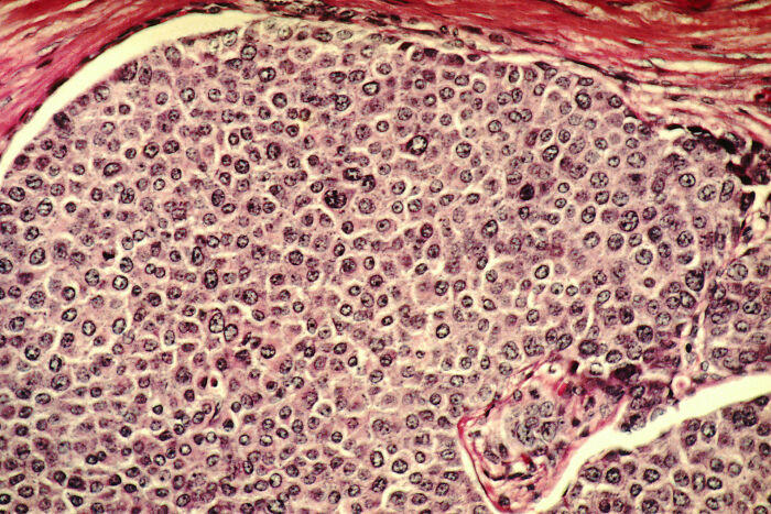 75 genuinely creepy biological realities of being a living human