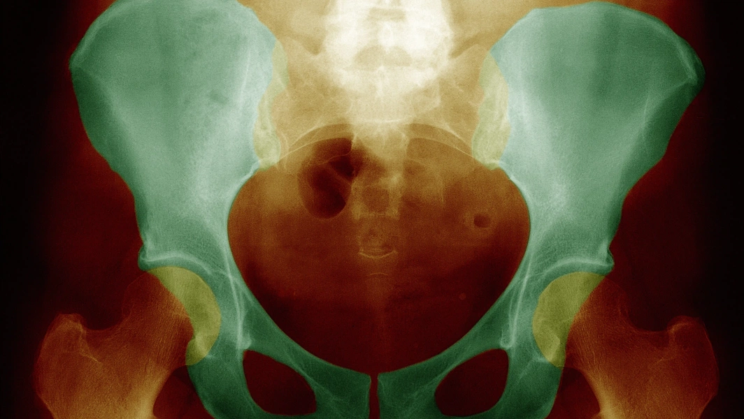 Understanding bone and blood cancers