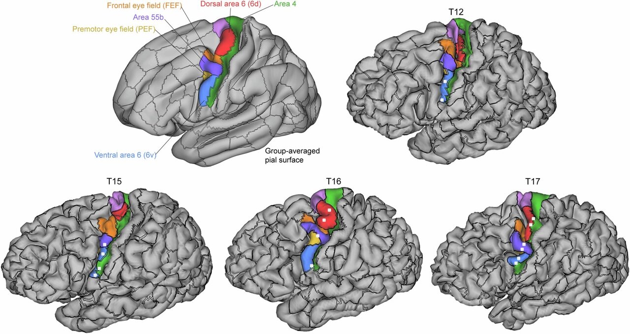 Update to 89-year-old motor homunculus model shows brain's motor cortex ...