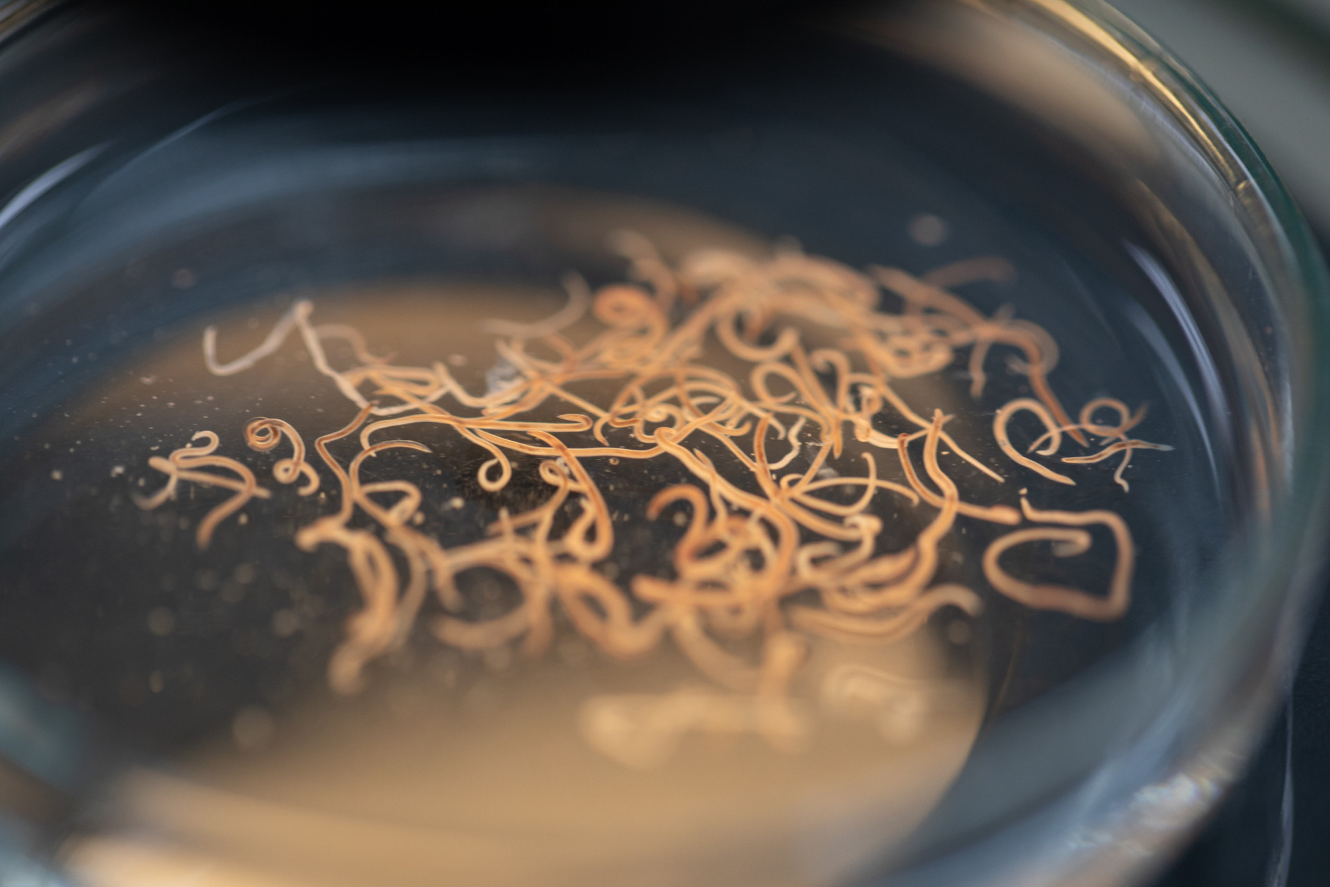 The 30 most terrifying parasitic diseases in the world
