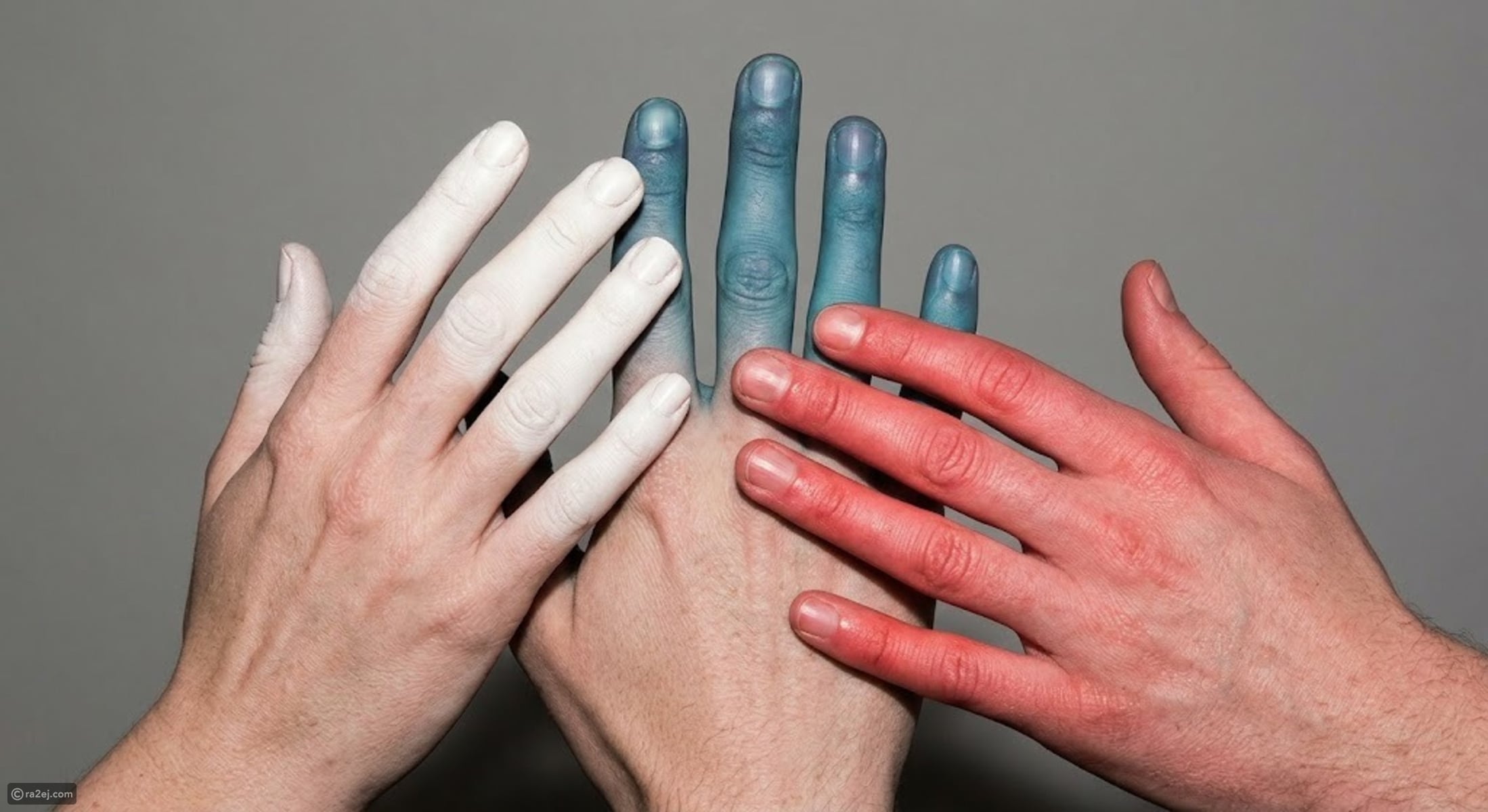People with cold hands and one other symptom urged to see a doctor