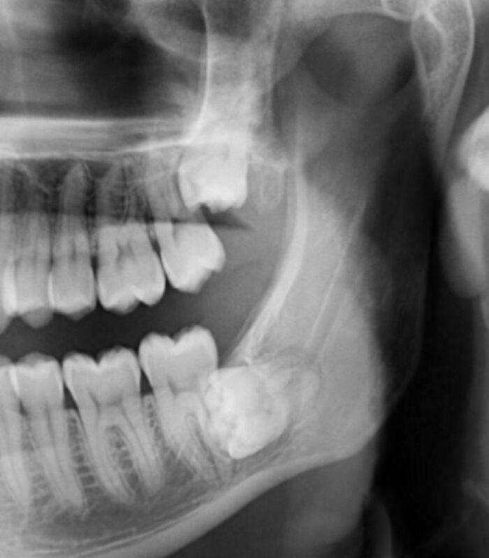 36 rare biological traits that show the wonders of human genetics
