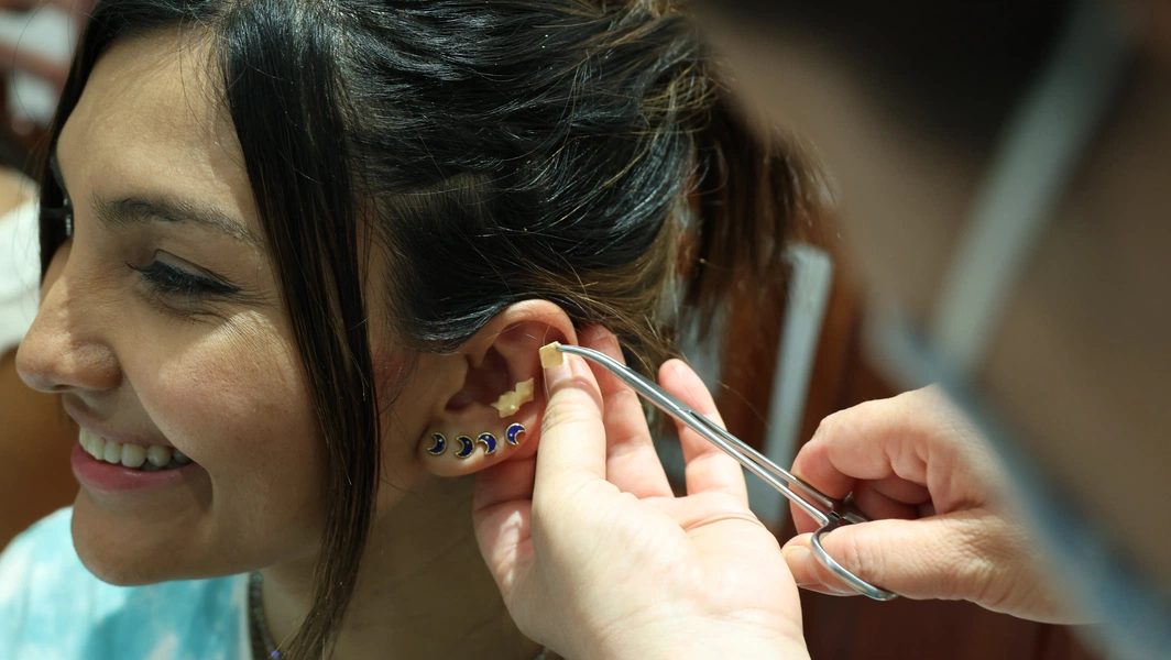 How ear seeds work and their potential benefits