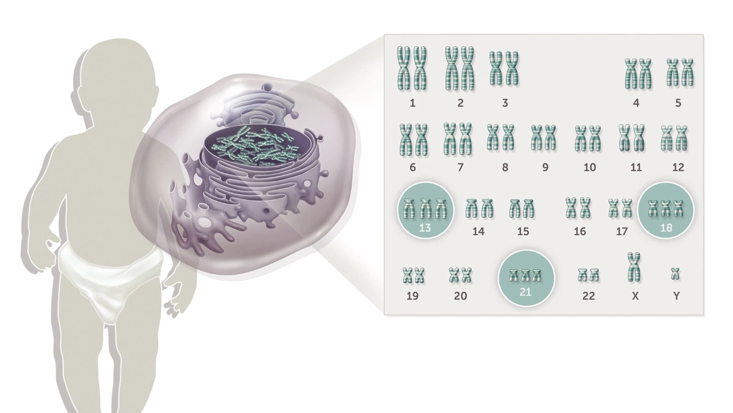 10 genetic disorders and their inheritance patterns