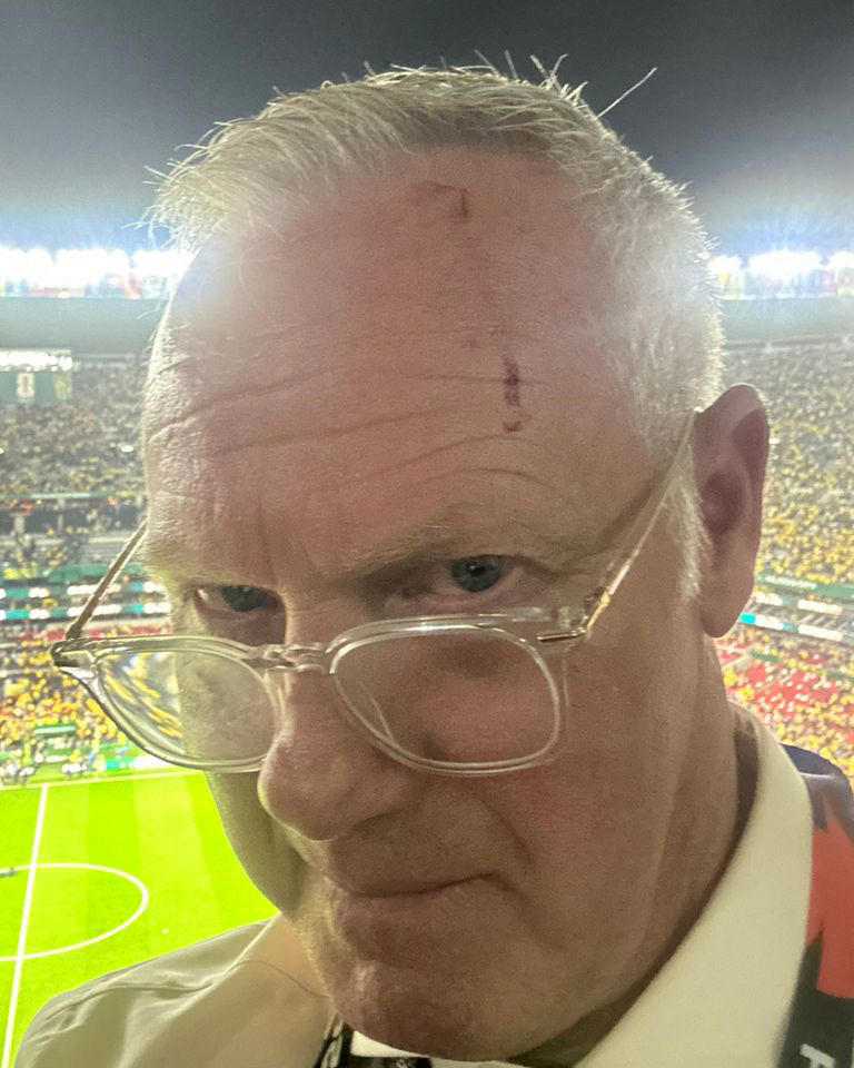 Fox World Cup broadcaster left bloodied after fan throws objects mid-game