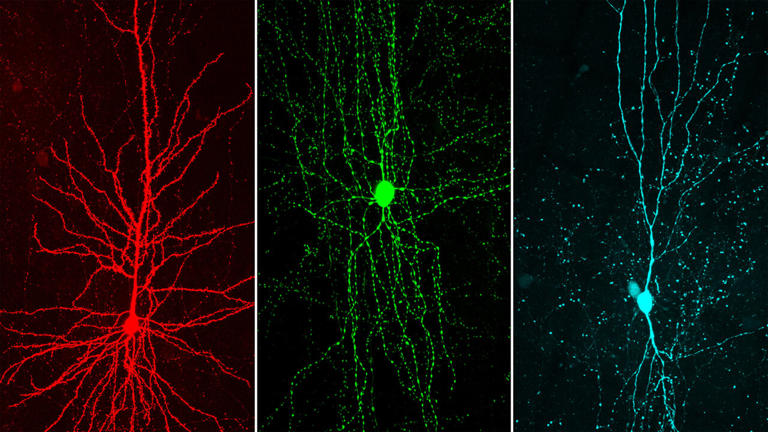 Brain cells reshape structure and function for vision and memory tasks ...