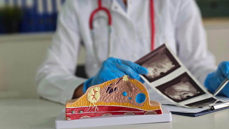 BCAL Diagnostics develops blood test to evaluate breast cancer