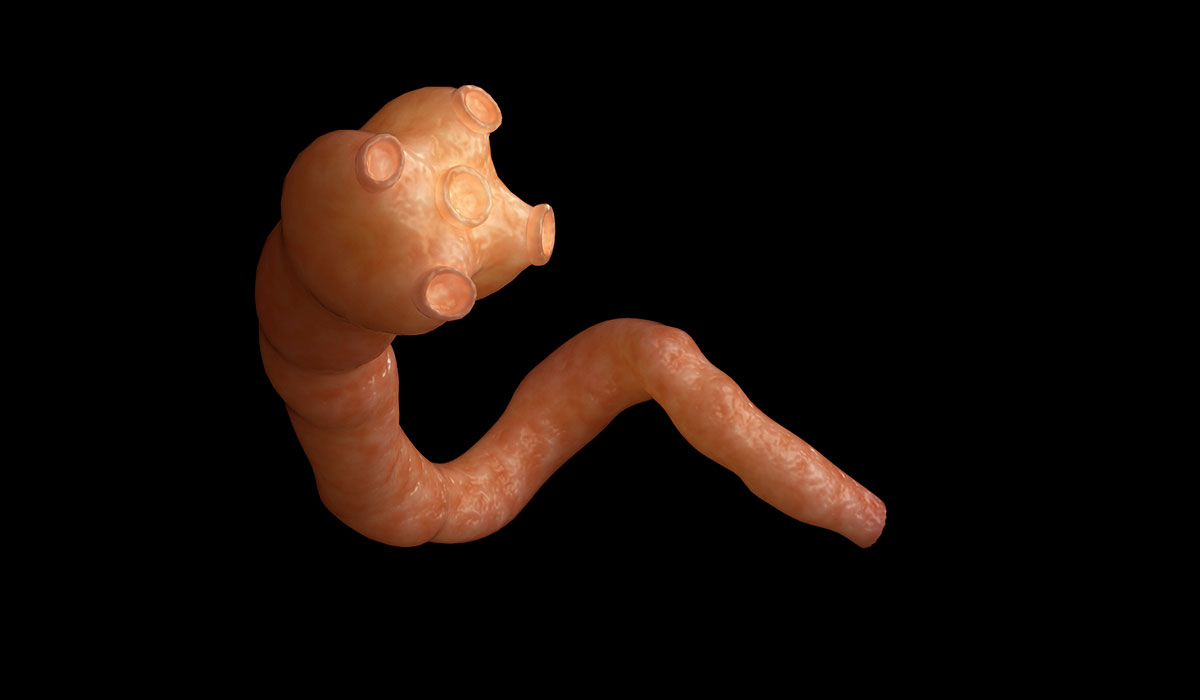 Urgent warning as common parasite now poses horrifying threat to Americans