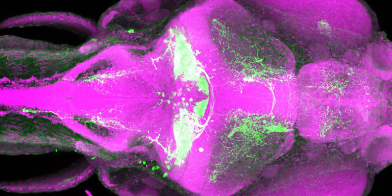 Restless legs syndrome—zebrafish reveal a cerebellar connection
